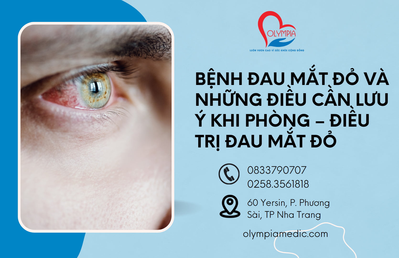 BỆNH ĐAU MẮT ĐỎ VÀ NHỮNG ĐIỀU CẦN LƯU Ý KHI PHÒNG – ĐIỀU TRỊ ĐAU MẮT ĐỎ ...