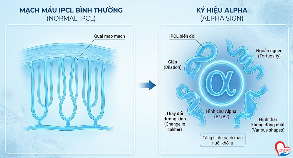 Dấu Hiệu Hình Chữ Alpha (α) Trên NBI - "Mật Mã" Của Ung Thư Thực Quản ...